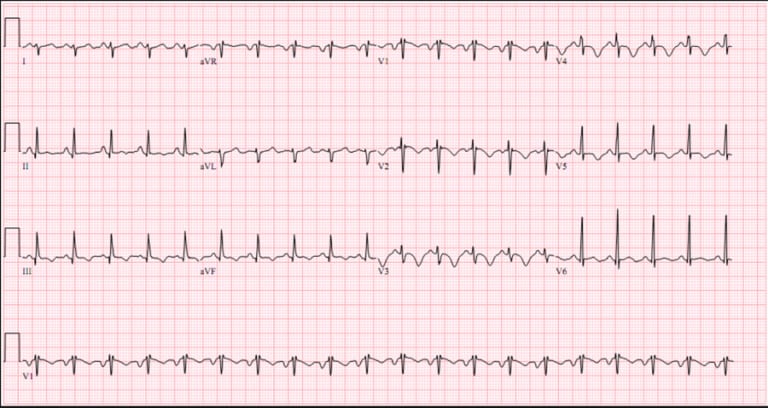 Sharp Chest Pain Scenario - Ambulance CPD