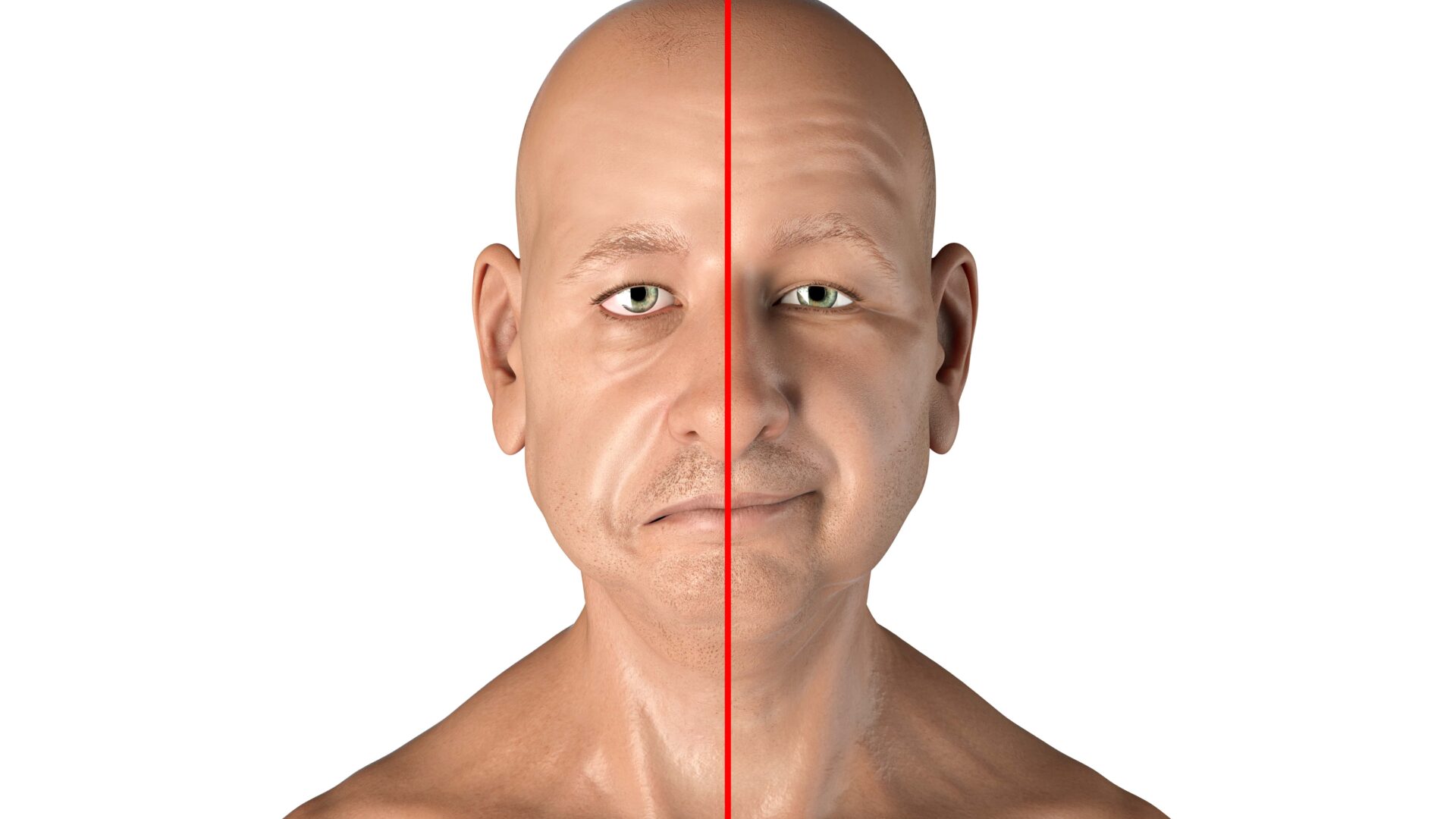 Facial Weakness Scenario - Ambulance CPD