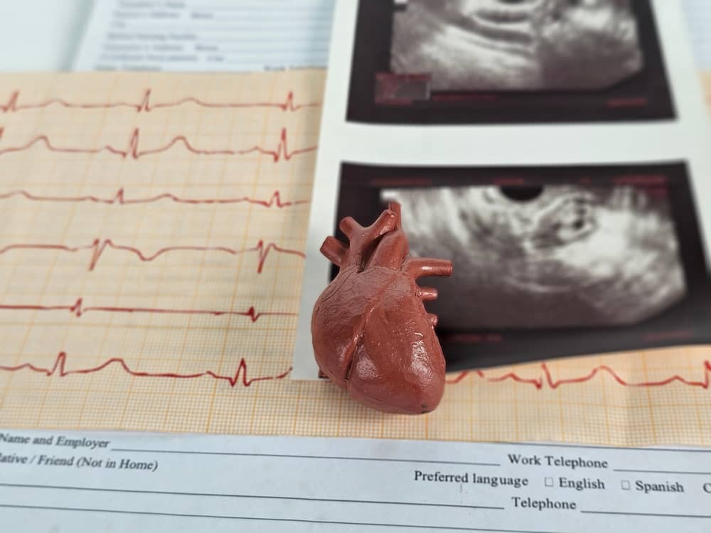Overview of the ECG - Ambulance CPD